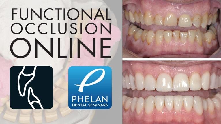 Functional Occlusion Online