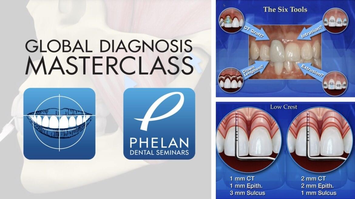 Global Diagnosis Masterclass